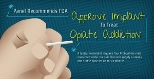 Panel Recommends FDA Approve Implant To Treat Opiate Addiction