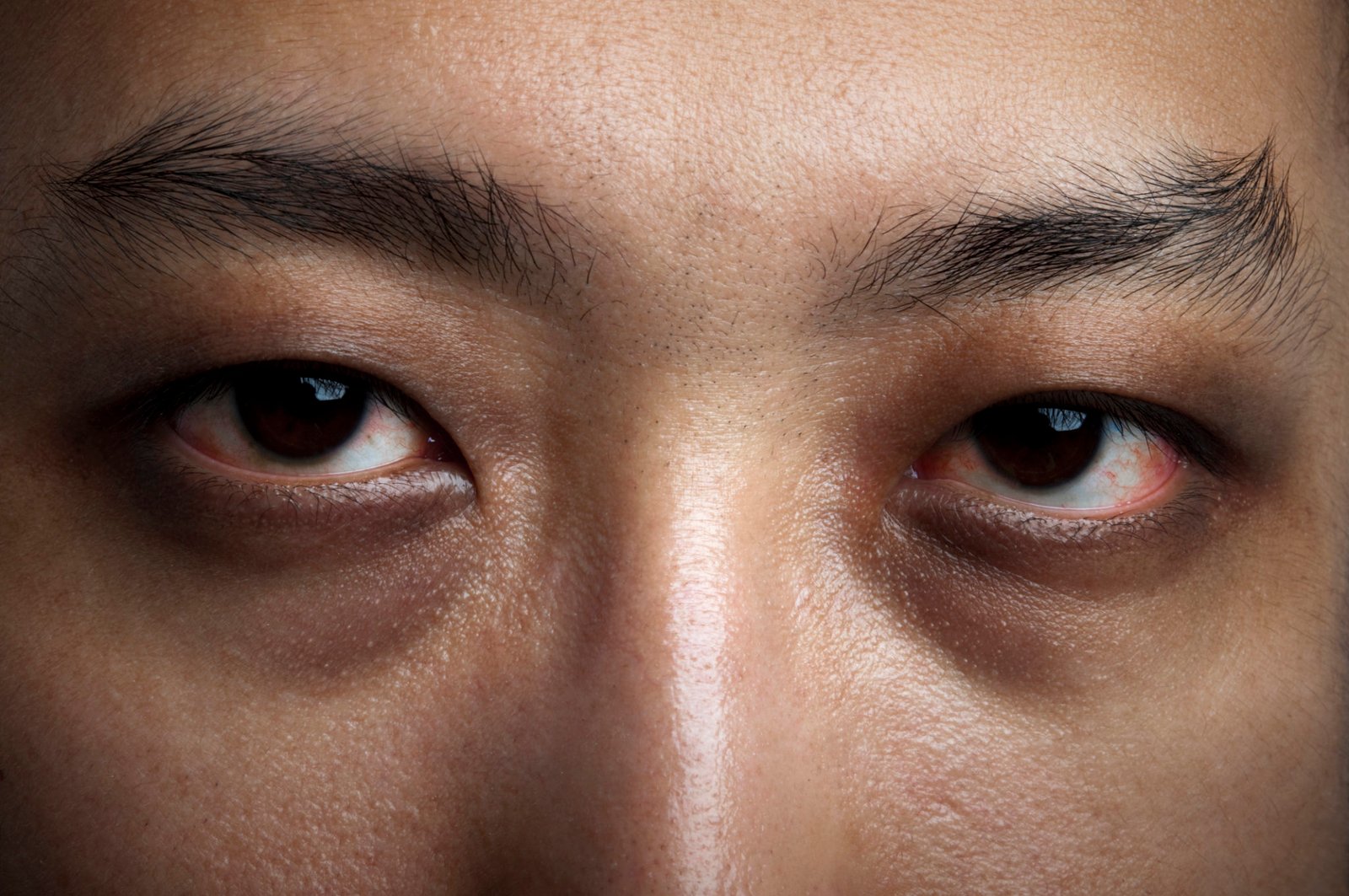 Examining a Drug Addict’s Face: What Drugs Do to Your Face - Rehab Center